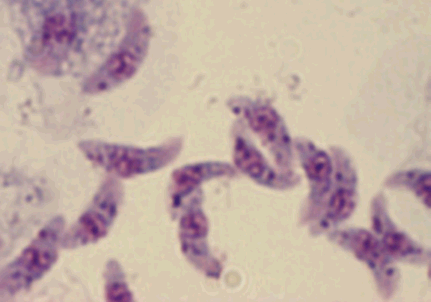 Toxoplasmosis & Pregnancy - Mar Vista Animal Medical Center